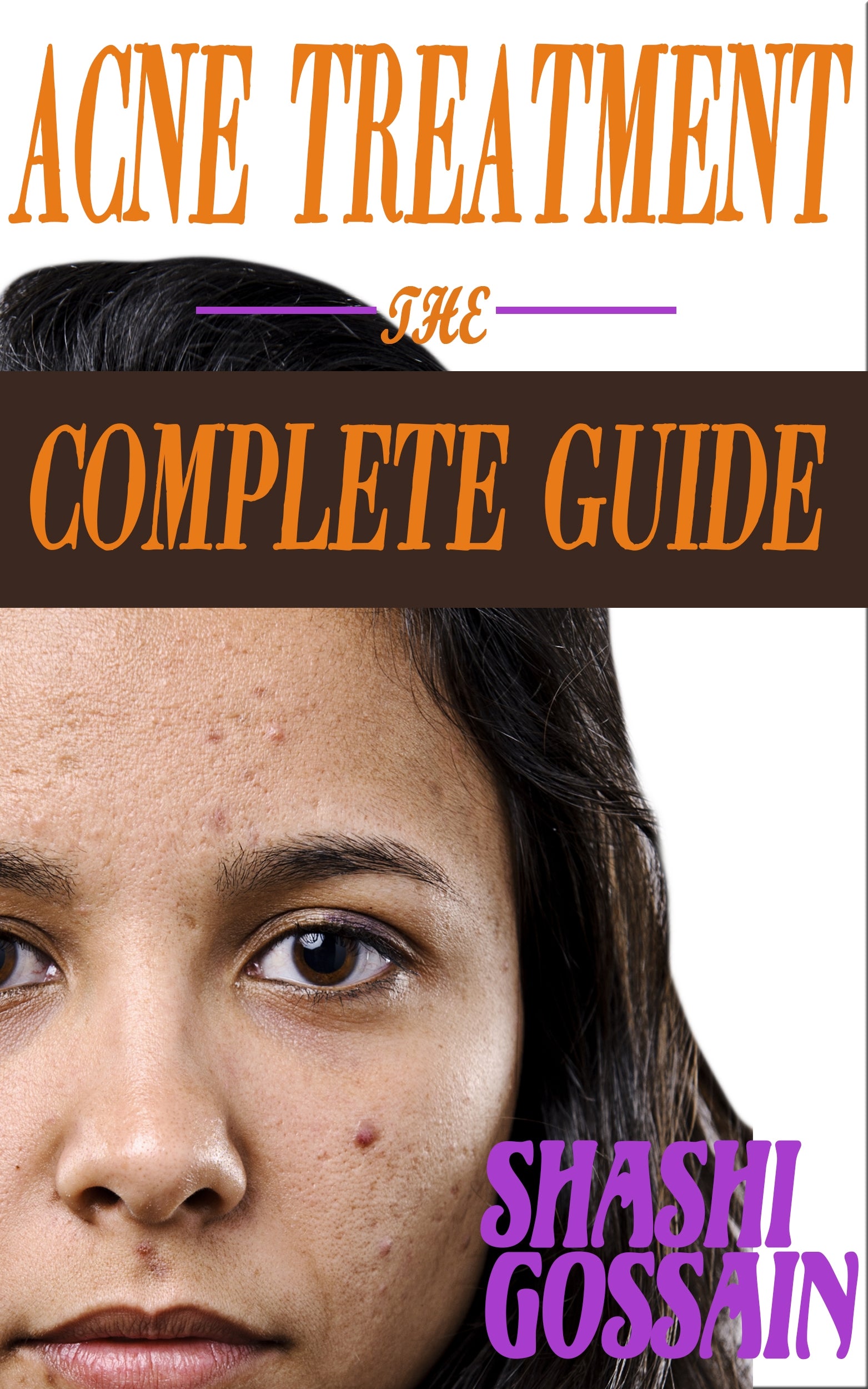Acne Treatment Book - Comprehensive Acne Treatment Guide – Pharmaclinix